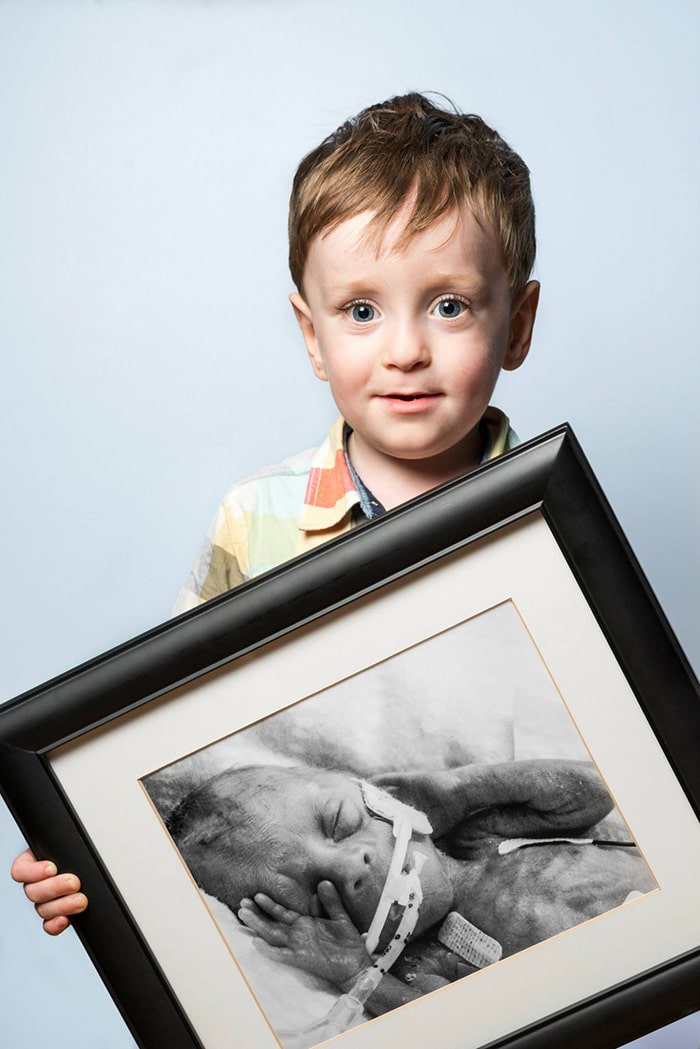 Inspiring Before-and-After Portraits of People Who Were Born ...