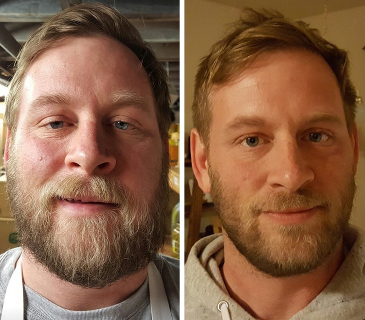 Before-and-After Photos Show Incredible Physical Changes of Life ...