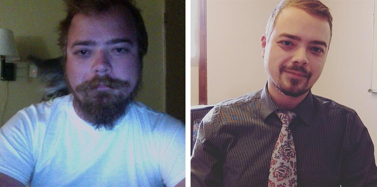 Before-and-After Photos Show Incredible Physical Changes of Life ...