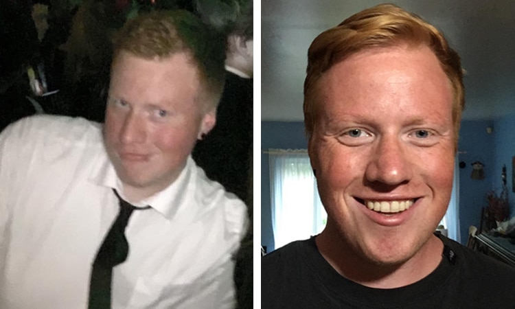 Before-and-After Photos Show Incredible Physical Changes of Life ...