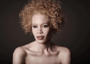 Stunning Model with Albinism Expands the Definition of Beauty