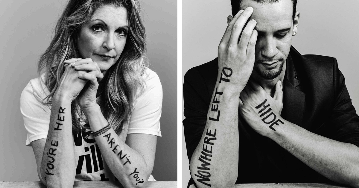 Moving Portraits of Pulse Nightclub Shooting Survivors, One Year Later