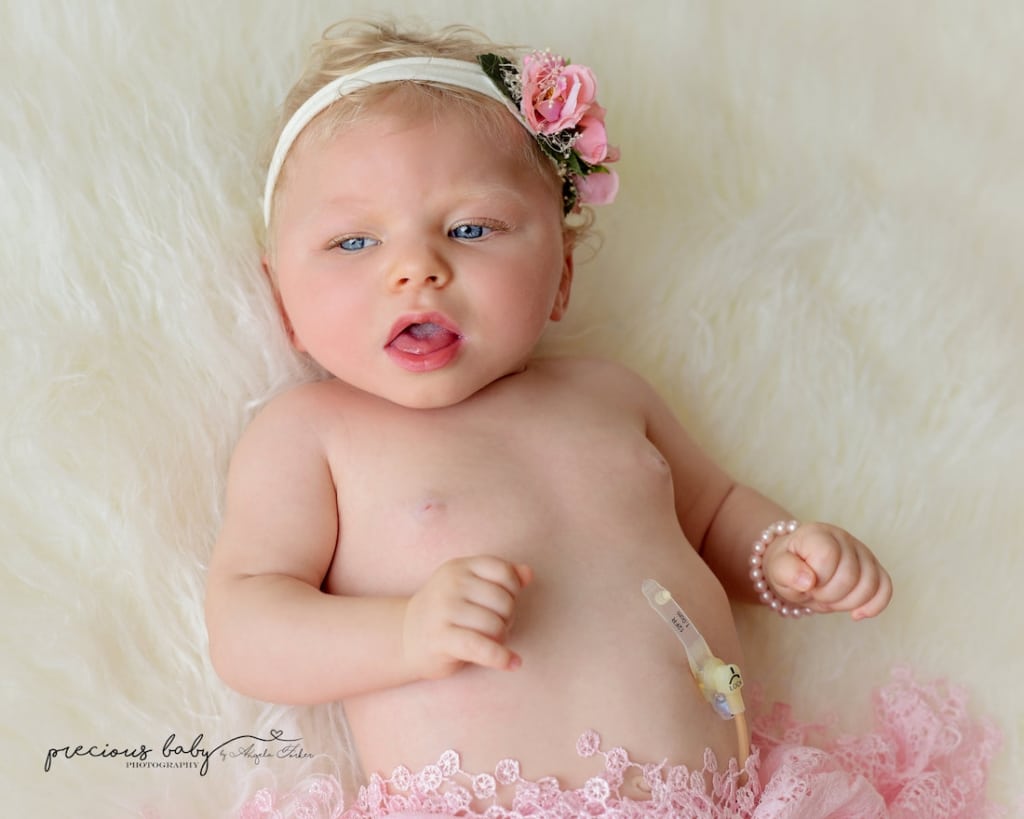 How 'The Precious Baby Project' Highlights Babies with Special Needs