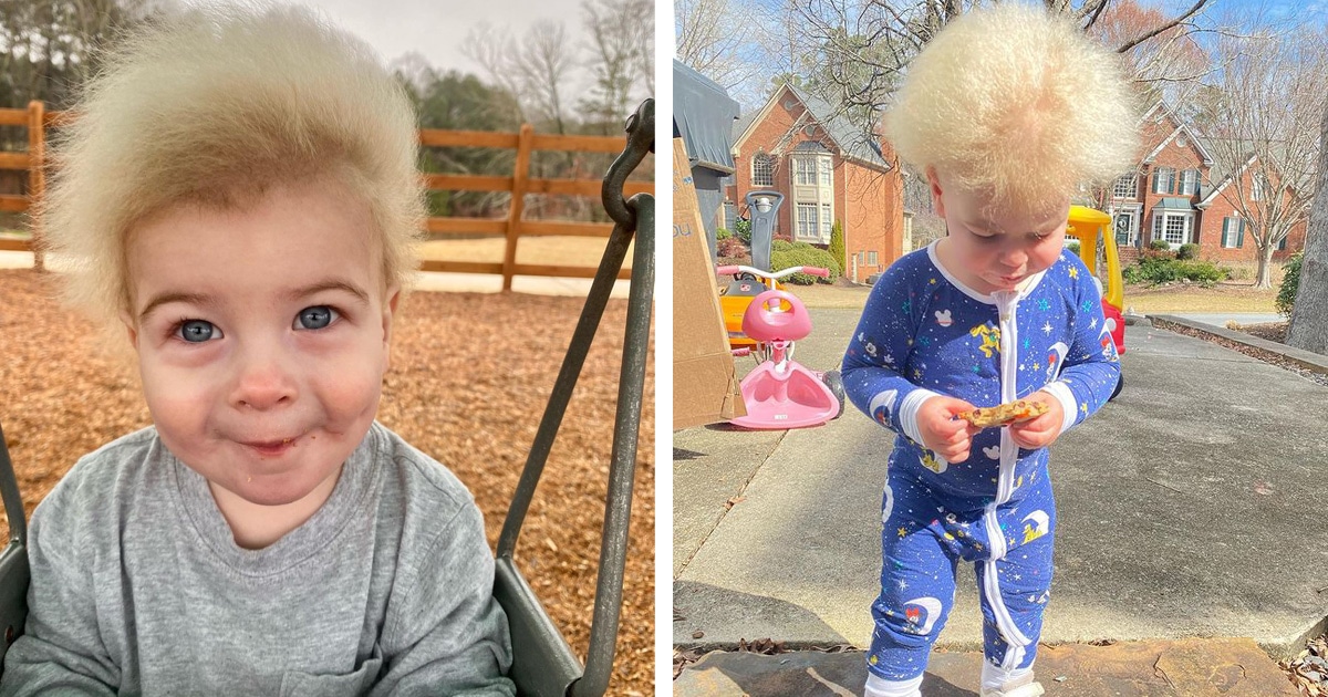 Toddler With Uncombable Hair Syndrome Has Untamable Rockstar Locks