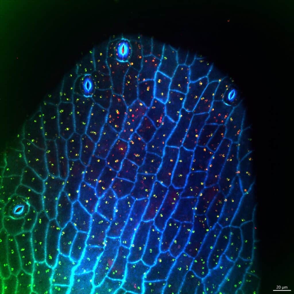 Incredible Winners of Light Microscopy Awards Show Artistry of ...