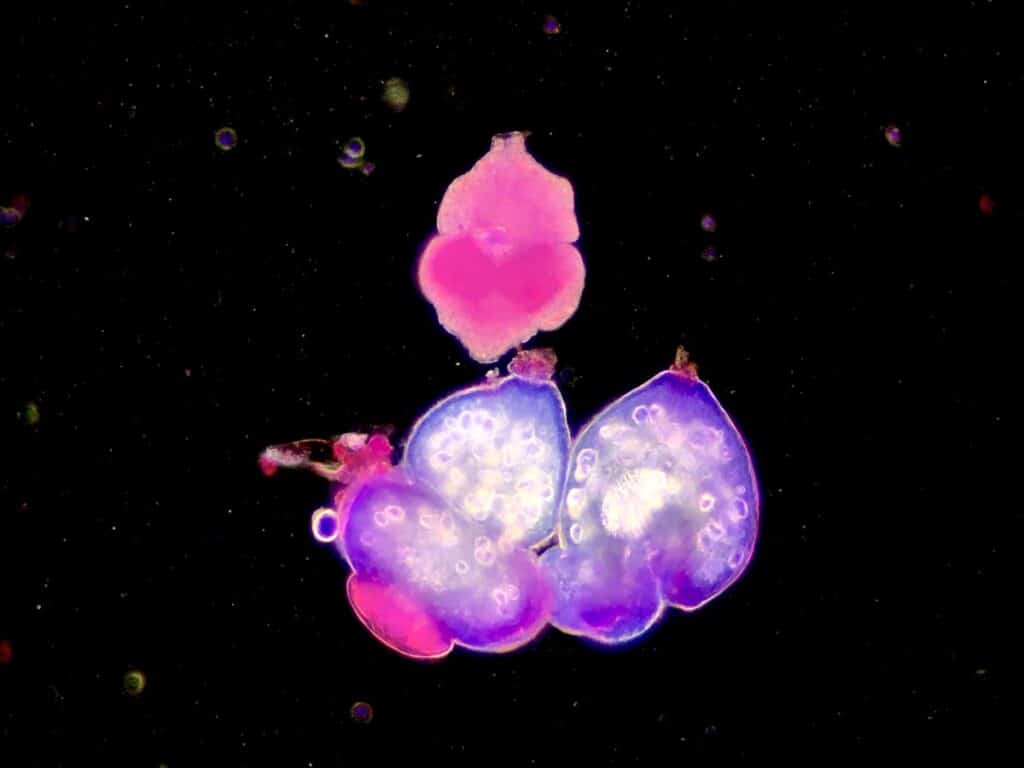 Incredible Winners of Light Microscopy Awards Show Artistry of ...