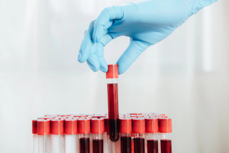 Japanese Researchers Will Start Clinical Trials for Artificial Blood